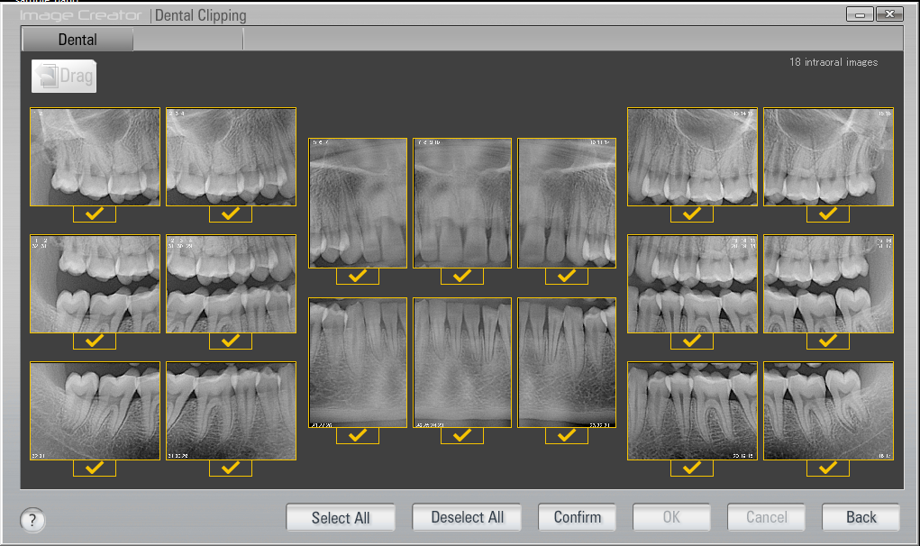 Panoura 18S with Full FMX Feature – Archer Dental