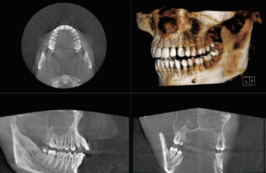 Panoura X-Era – Archer Dental
