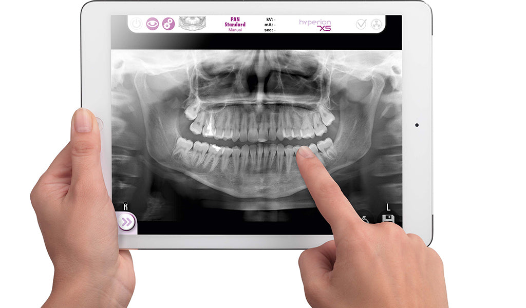 MyRay Hyperion X5 CBCT – Archer Dental