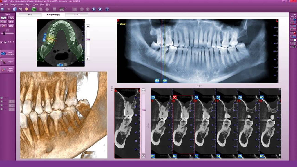 MyRay Hyperion X5 CBCT – Archer Dental