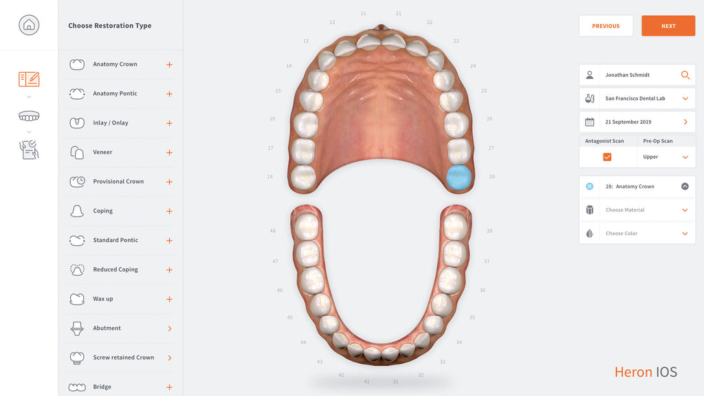 3DISC Heron™ IOS Intraoral Color Impression Scanner with Laptop and So – Archer Dental